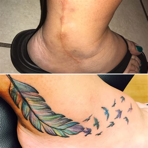 Scar Cover Up Tattoos To Cover Scars Scars Tattoo Cover Up Tattoo