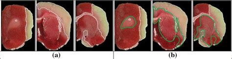 A Schematic Diagram Of Image Binarization A The Results Of Download Scientific Diagram