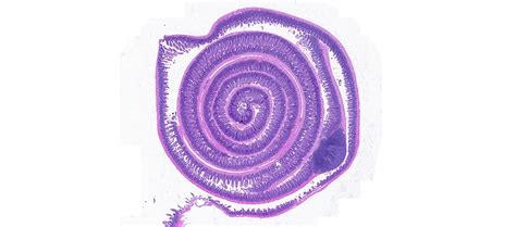 Ihc Vs If Immunohistochemistry Or Immunofluorescence Key Differences Explained