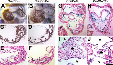 Defective Myocardial Development And Endocardial Cushion Formation In Download Scientific