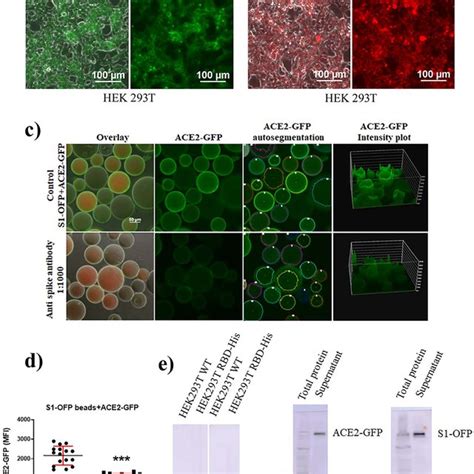 A Validation Of The S1 Ofp Ace2 Gfp Bead Assay Using Diverse Download Scientific Diagram