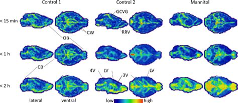 Spatiotemporal Distribution Of Gd Dota Accumulation In Brain Tissue And Download Scientific