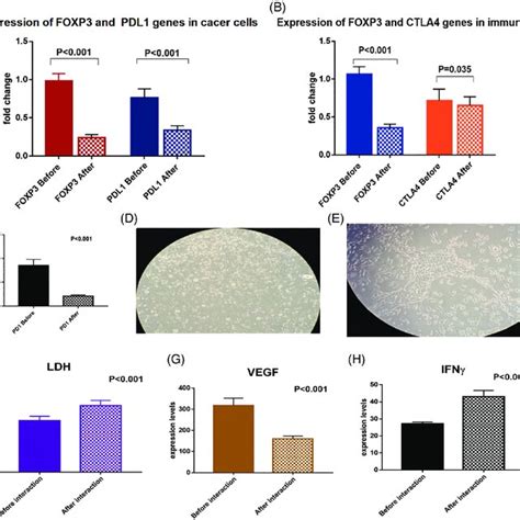 A Expression Levels Of Foxp3 And Pdl1 Genes In Breast Cancer Cells