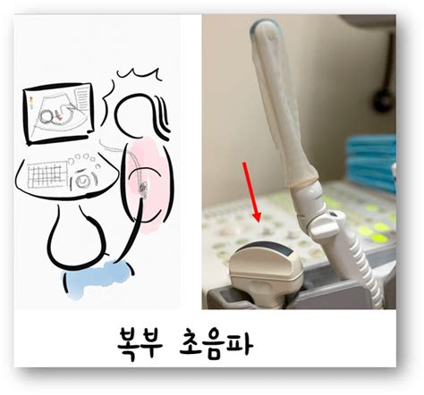 질 초음파 복부 초음파 항문 초음파