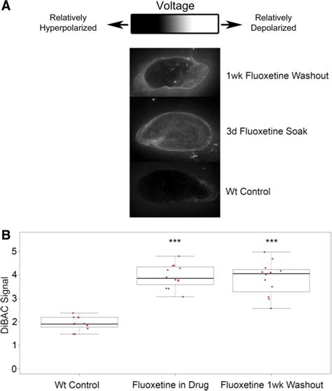 Post SSRI Sexual Dysfunction A Bioelectric Mechanism PMC