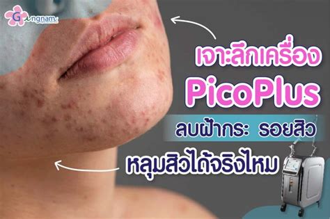 หลังทํา Pico Laser ควรดูแลตัวเองยังไง มีข้อห้ามอะไรบ้าง