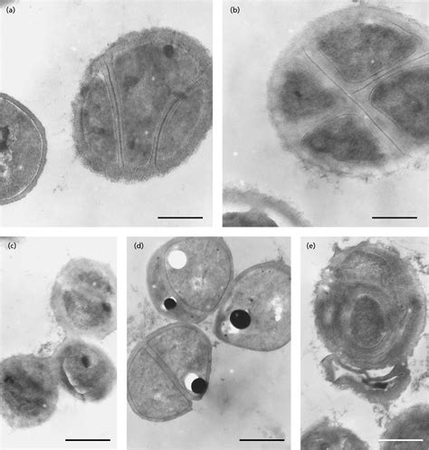 Staphylococcus Succinus Semantic Scholar