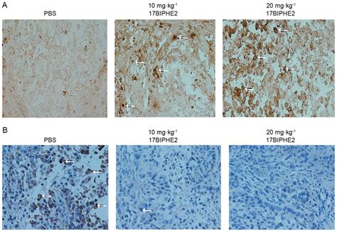 17biphe2 Suppresses Lung Tumor Growth And Inhibits Proliferation In