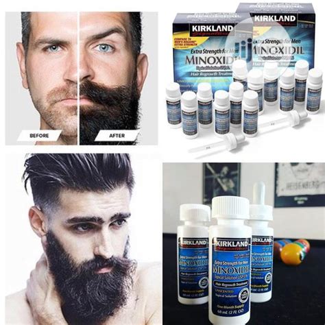 Kirkland Minoxidilsolution For Baldness And Beard Growth Health Nigeria