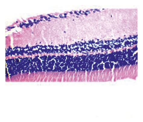 Observation Of The Retinal Structure Of Each Group By He Staining Download Scientific Diagram
