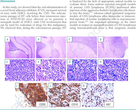 Histological And Immunohistochemical Phenotype Of The DLBCL Model With Download Scientific