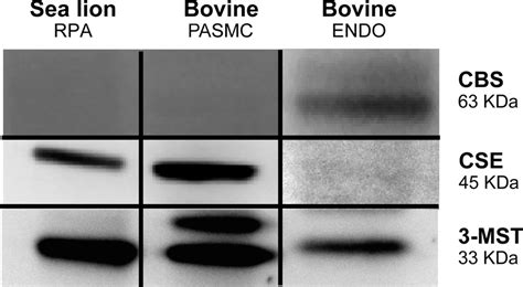 western blots of h2s synthesizing enzymes cystathionine synthase