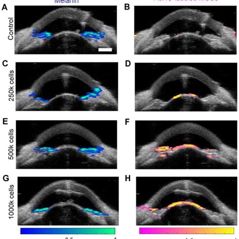 Three Dimensional Ultrasound Photoacoustic Imaging To Detect Location Download Scientific