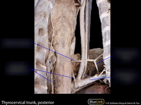 Thyrocervical Trunk Posterior Diagram Quizlet