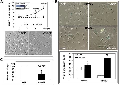 Notch Activation Induces Endothelial Cell Senescence And Pro Inflammatory Response Implication