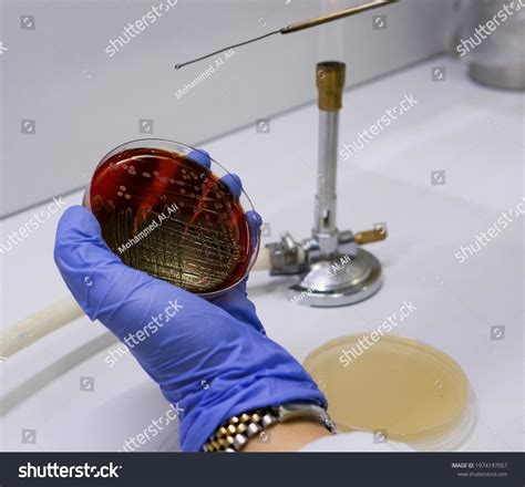 466 Inoculating Loop Images Stock Photos Vectors Shutterstock