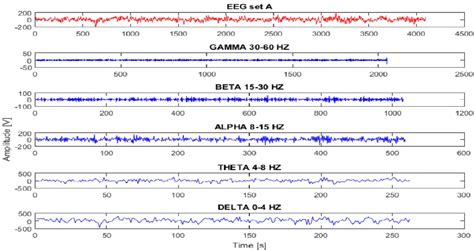 Figure 3 From A Hybrid Automated Detection Of Epileptic Seizures In Eeg Based On Wavelet And