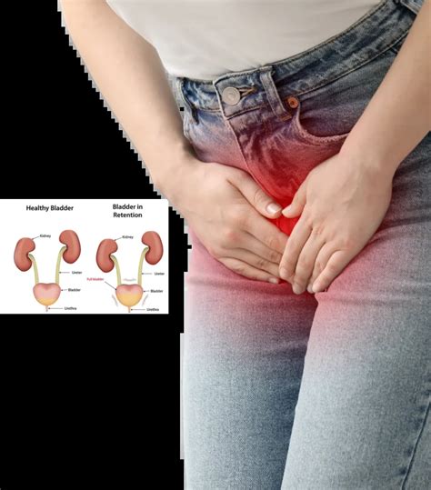Urinary Retention Treatment In Hyderabad Lux Hospitals