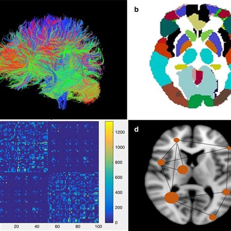 Brain Network Analysis A Whole Brain Tractography Created From The Fa