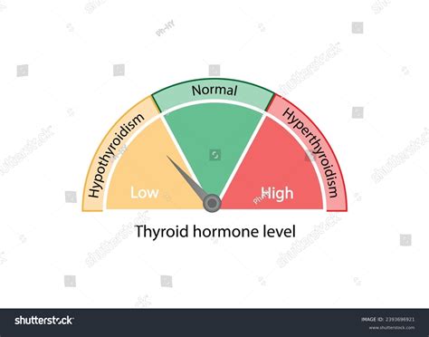 Thyroid Function Test Thyroid Gland Hypothyroidism Stock Vector