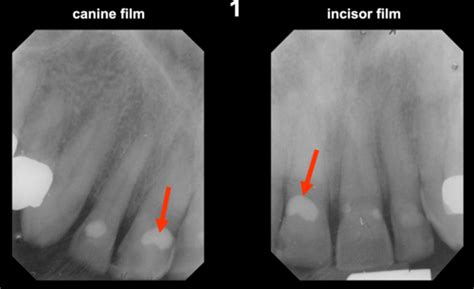 Object Localization Flashcards Quizlet