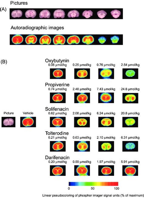 A Representative Autoradiographic Images Distribution Of Download Scientific Diagram