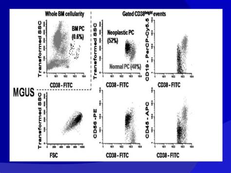 Dr Nahla Farahat Immunophenotyping Of Multiple Myeloma Pps