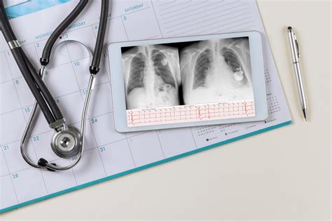 Differenza Tra Loop Recorder E Pacemaker At Darlene Thompson Blog