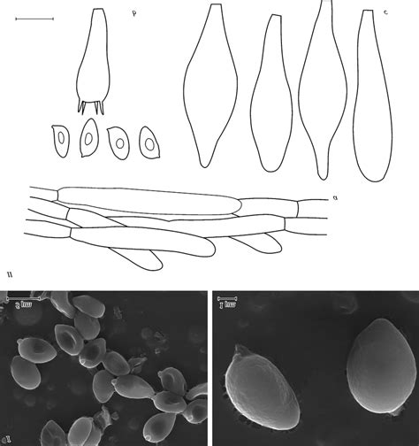Leucoagaricus Lateritiopurpureus I Basidiospores Under Scanning Download Scientific Diagram