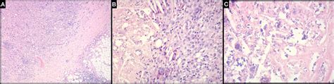 Histological Examination Of Surgical Specimen Download Scientific Diagram