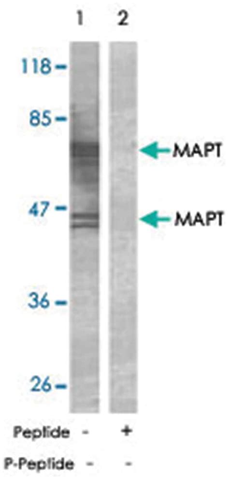 Anti Mapt Antibody 100ug