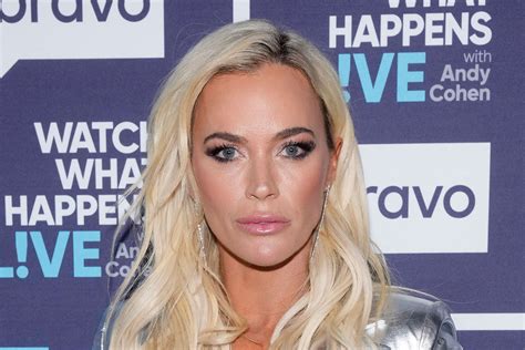 Teddi Mellencamp Admits To Mistakes In Update Amid Split The Daily Dish