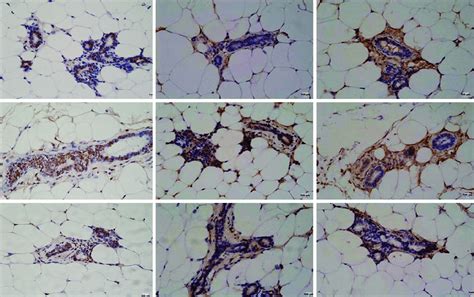 Recombinant Human Granulocyte Colony Stimulating Factor Rhg Csf Download Scientific Diagram