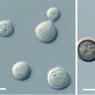 PDF Cryptococcus And Cryptococcosis