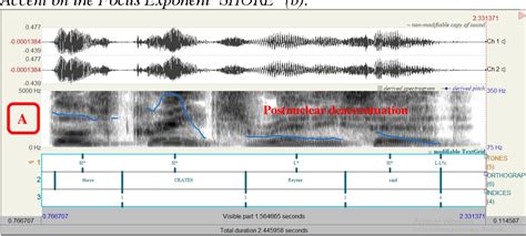 Figure 11 From Does Syntactic Markedness Override The Prosodic Prominence Of Focus Semantic