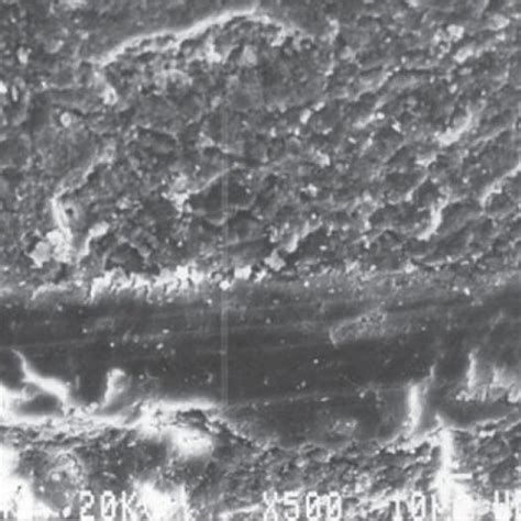 Morphology Of The Root Surface Of The Control Specimen Scanning