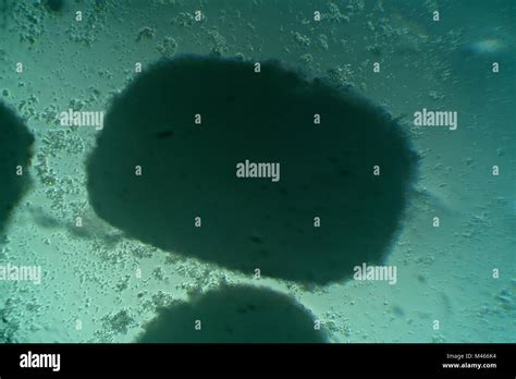 Yeast Microscope Hi Res Stock Photography And Images Alamy