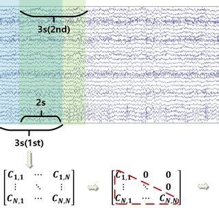 The Scheme Of EEG Segmentation A For Time Series Of Each Trial A Download Scientific