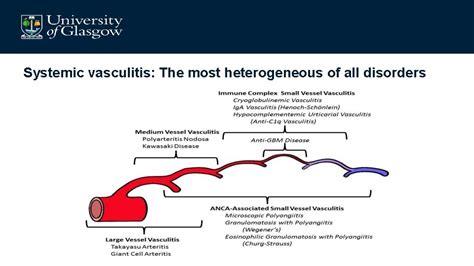 Unmet Need And Challenges In Vasculitis Scottish Systemic