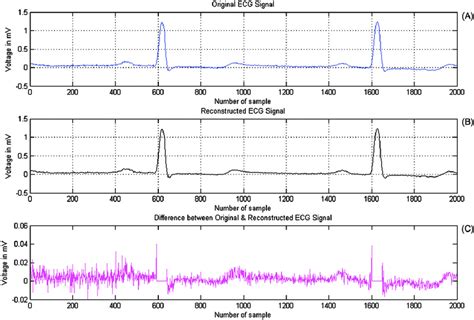 Original Ecg Signal Blue A Reconstructed Ecg Signal Black B Download Scientific Diagram