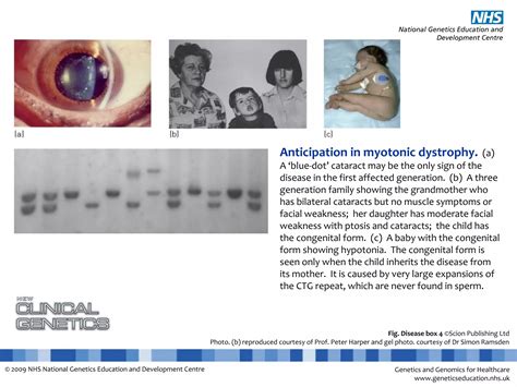 Clinical Photos Autosomal Dominant Conditions Ppt