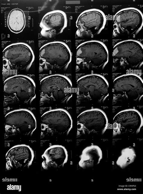 X Ray Head