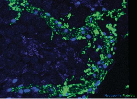 Neutrophil Association With Platelet Coated Endothelium In The Inflamed Download Scientific