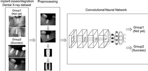 Flowchart For Osseointegration Prediction Group 1 Radiography Was
