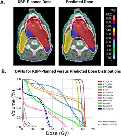 Deep Learningbased Dose Prediction For Automated Individualized Quality Assurance Of Head And