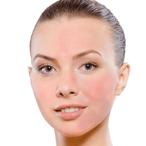 Do You Have A Sensitive Skin Type • Nascent Skin And Beauty Clinic