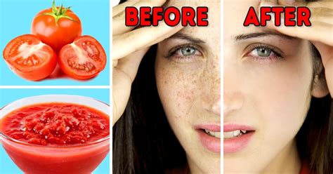 16 Natural Remedies To Get Rid Of Sunspots With Natural Remedies