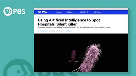 pbs using artificial intelligence to spot hospitals silent killer bayesian health