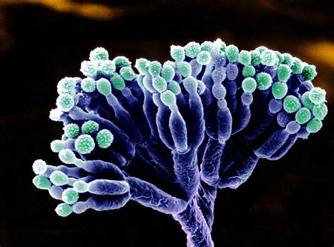 Bacterial Spores Examples Sjfiko