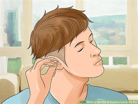 Ways To Get Rid Of Pimples Inside The Ear WikiHow